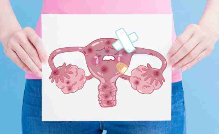 Kanser Nedir? Nasıl Oluşur? Tümör Nedir? | Sağlık Portalı